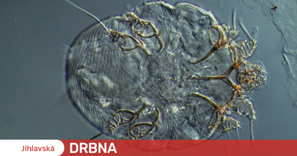 Vysočinou se i nadále šíří svrab. Hygienici od ledna evidují 172 ...